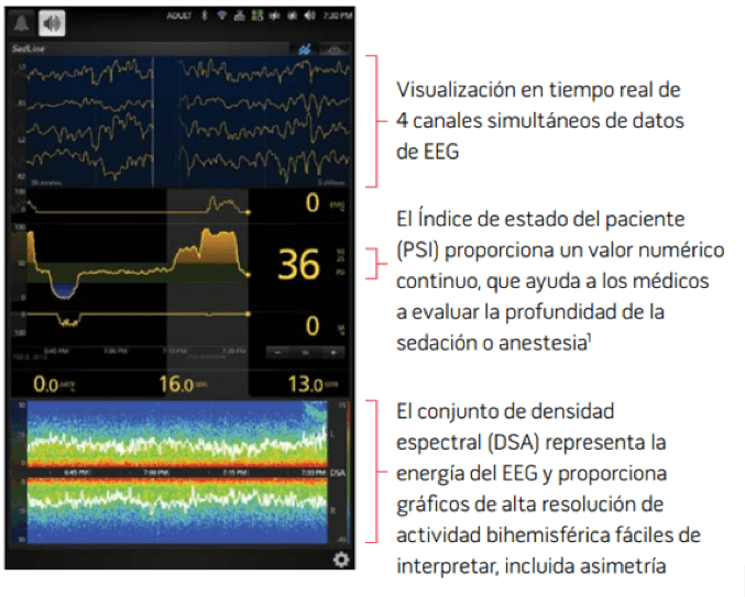 Plataforma de Monitoreo - Root - MASIMO - PV Equip