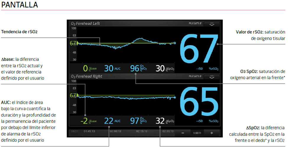 Plataforma de Monitoreo - Root - MASIMO - PV Equip