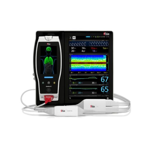 Plataforma de Monitoreo - Root - MASIMO - PV Equip